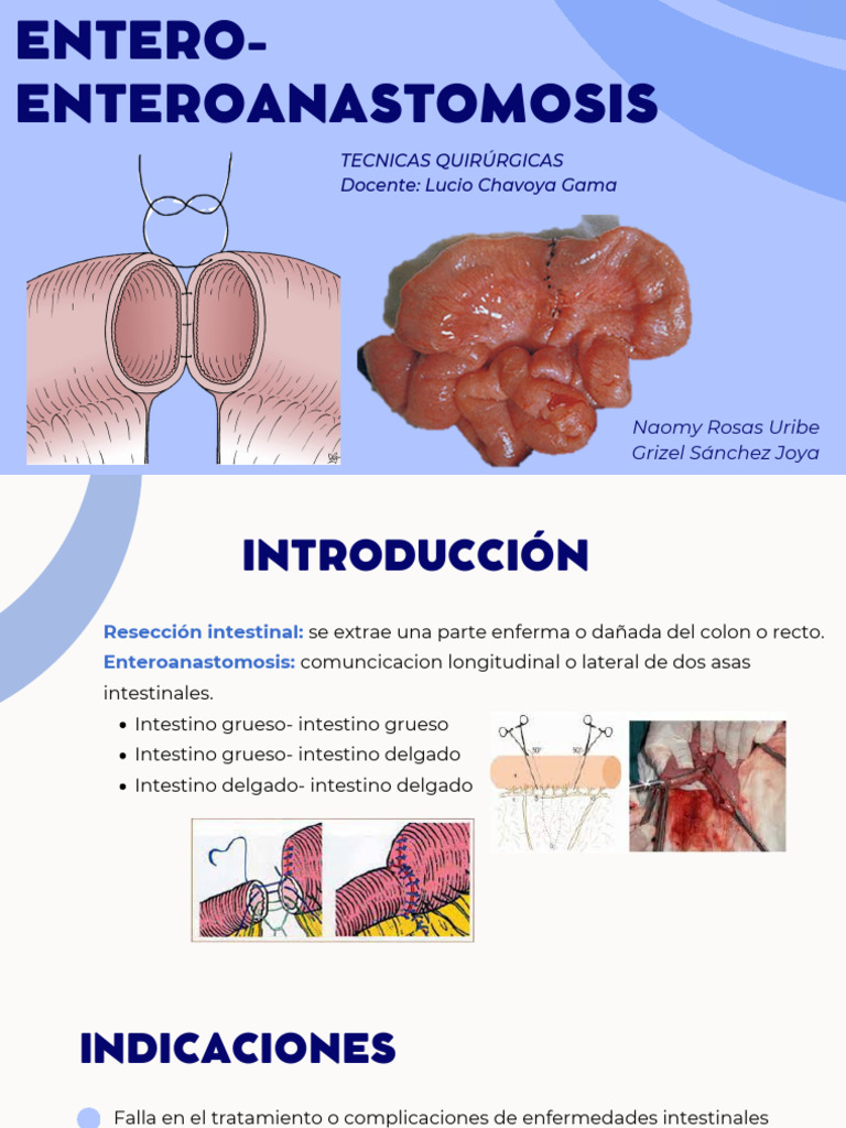 Técnicas de Enteroanastomosis Intestinal | PDF | Tracto ...