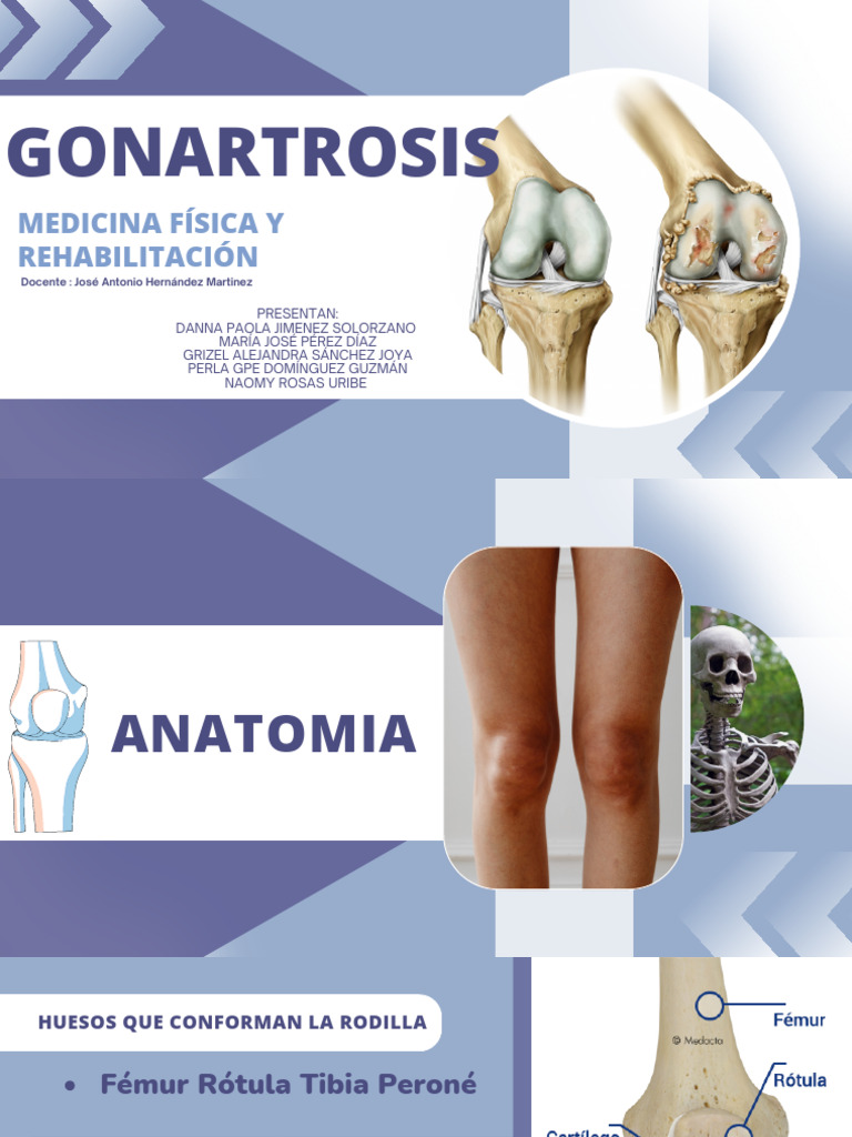 Gonartrosis: Diagnóstico y Tratamiento | PDF | Rodilla | Sistema ...