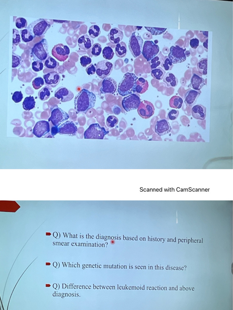 Pathology Leukemia And Leukocytosis 2 Pdf