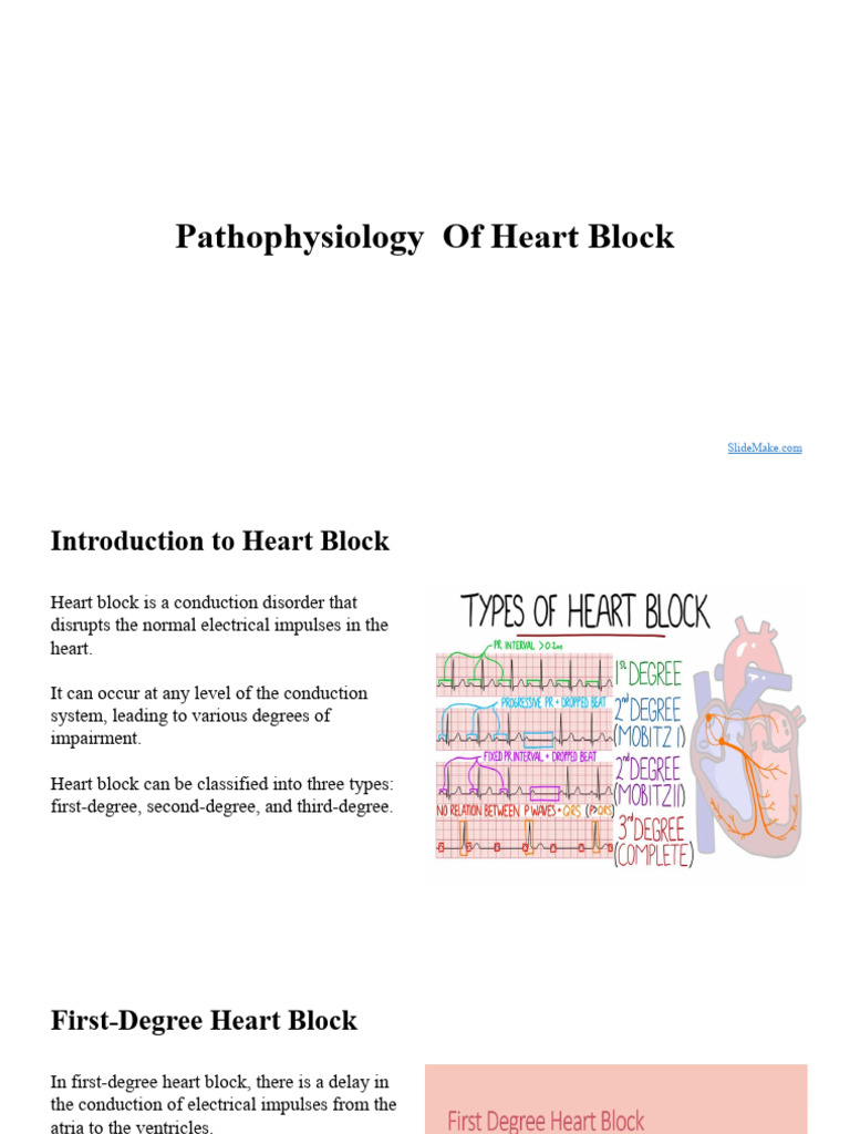 Heart Block Pathophysiology Overview | PDF | Heart | Electrophysiology