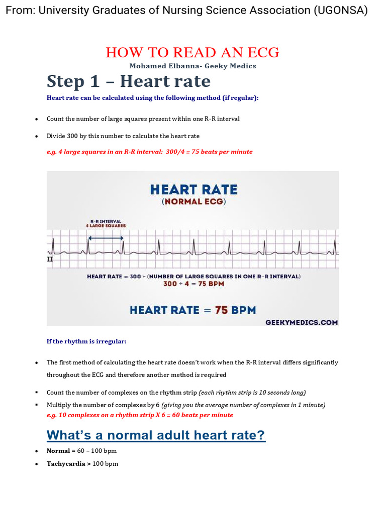 ECG - How To Read An ECG | PDF | Electrocardiography | Causes Of Death
