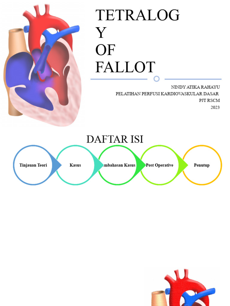 Tetralogy of Fallot | PDF