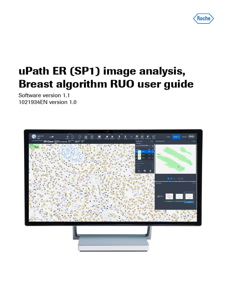 Upath ER (SP1) 1021934EN - 1 | PDF | Immunohistochemistry | Staining