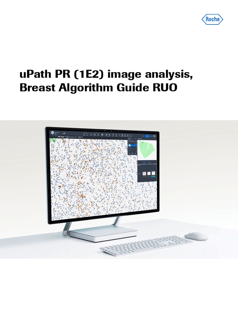 Upath PR (1E2) RUO Algorithm 1020752EN - 1 | PDF | Immunohistochemistry ...