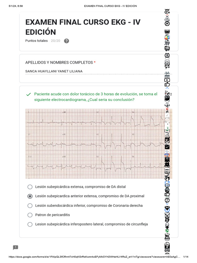 Examen Final Curso Ekg - IV Edición | PDF | Electrocardiografia | Sistema cardiovascular