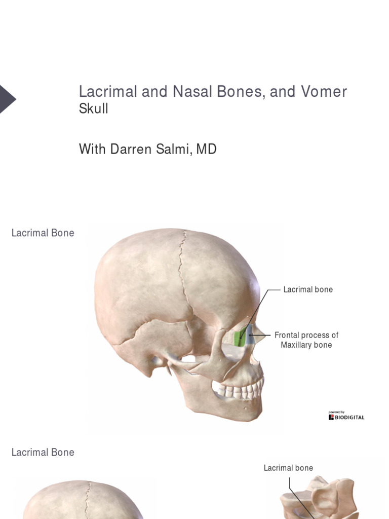 Slides Anatomy Lacrimal Nasal Bones Vomer | PDF