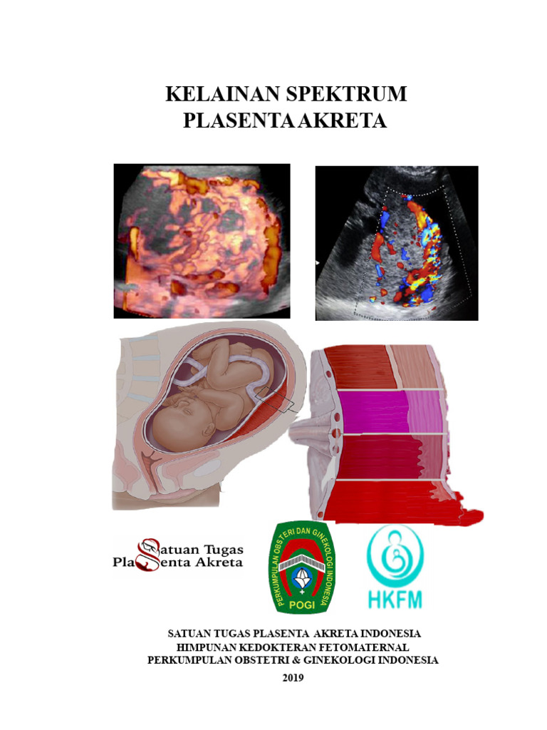 Buku Plasenta Akreta | PDF