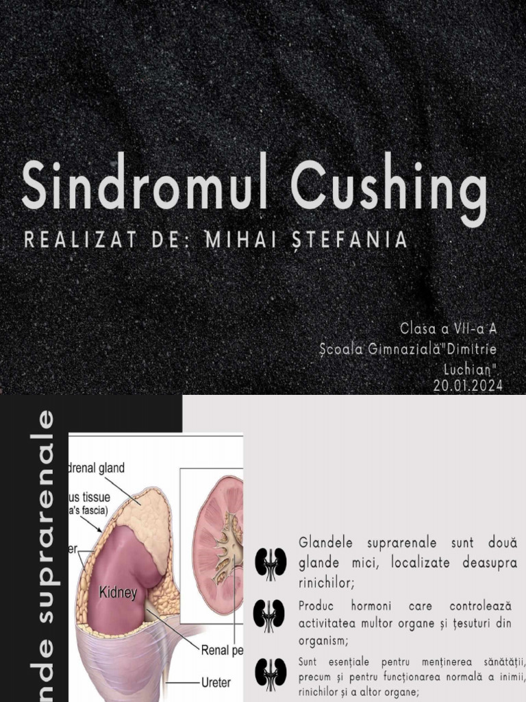 Sindromul Cushing | PDF