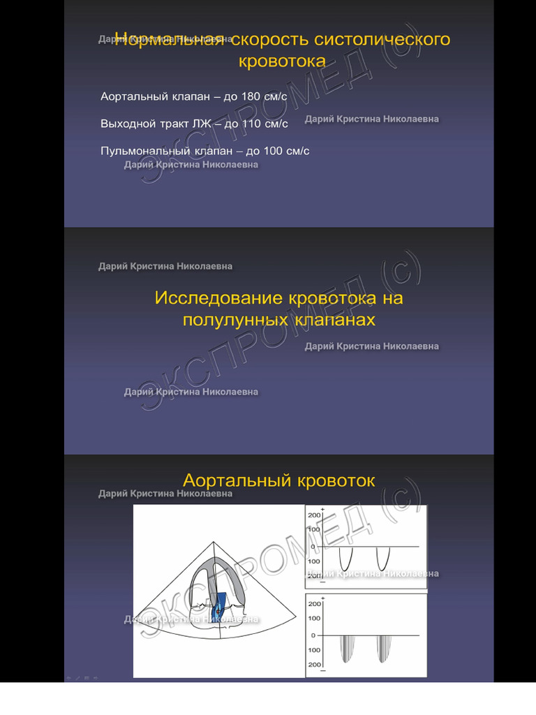 USG Valve Semilunare - 114259 | PDF