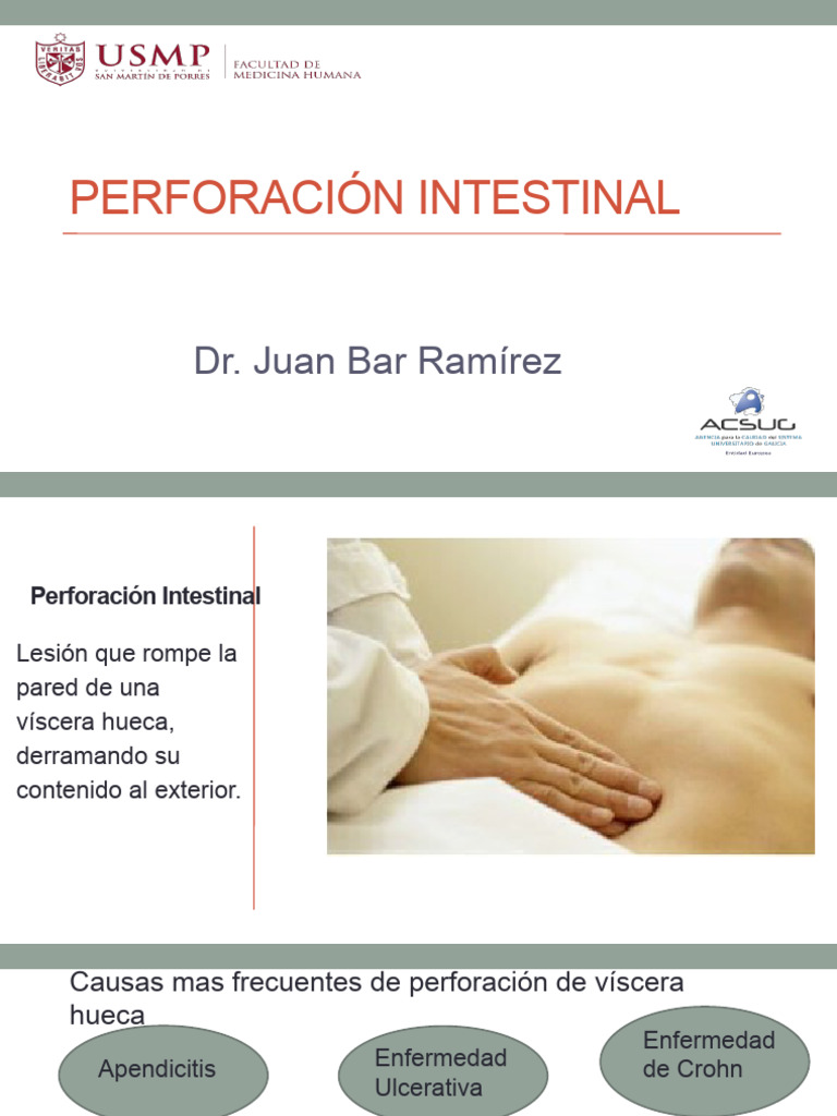 Perforación Intestinal Enam | PDF | Abdomen | Especialidades Medicas