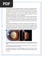 Diaz Apaza Anthony Jesus-Diascopia - Vitropresion | PDF ...