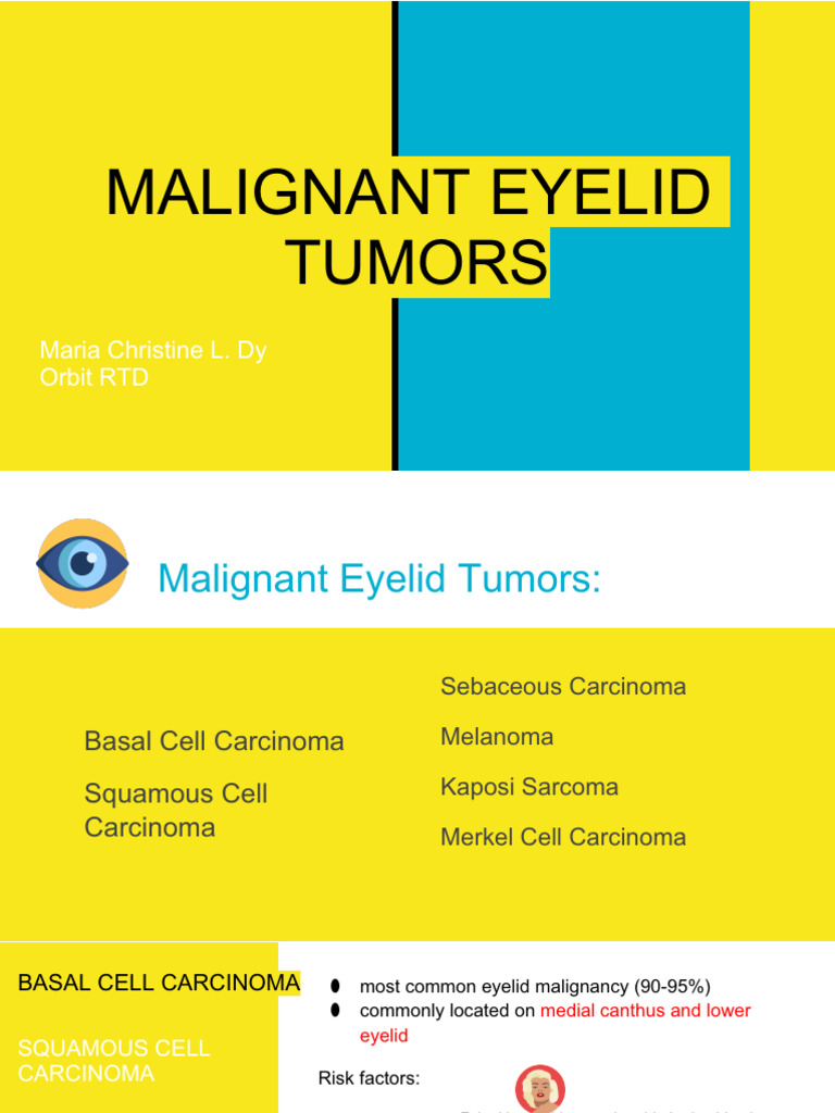 Malignant Eyelid Tumors | PDF