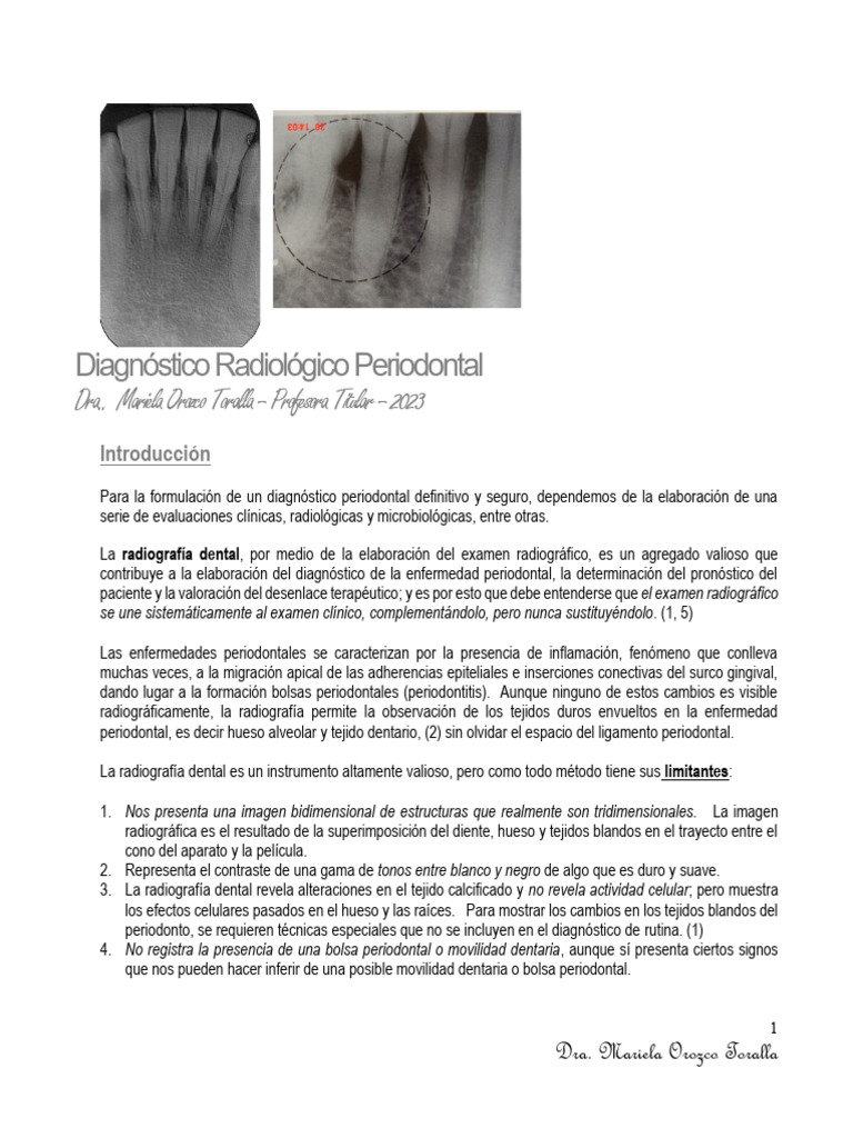 DX Radiologico Periodontal 2023 | PDF