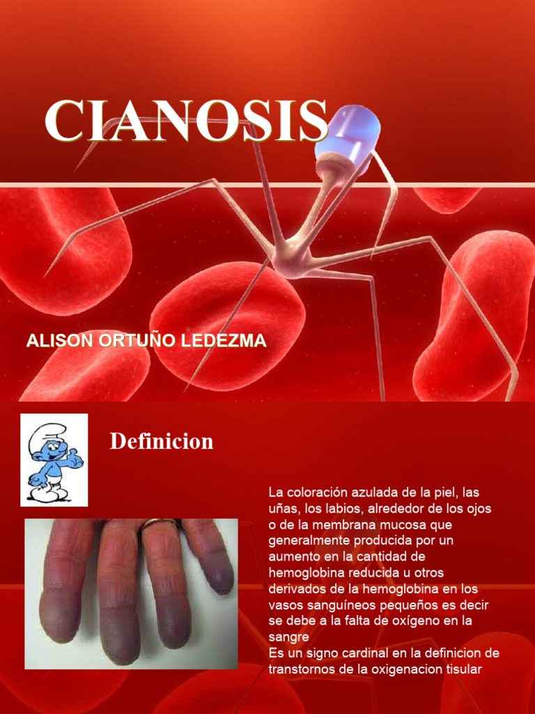 CIANOSIS | PDF | Enfermedades y trastornos | Medicina