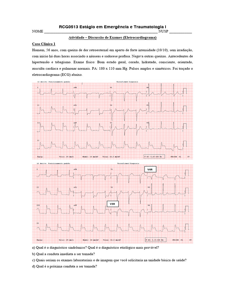 Atividade ECG Curso | PDF