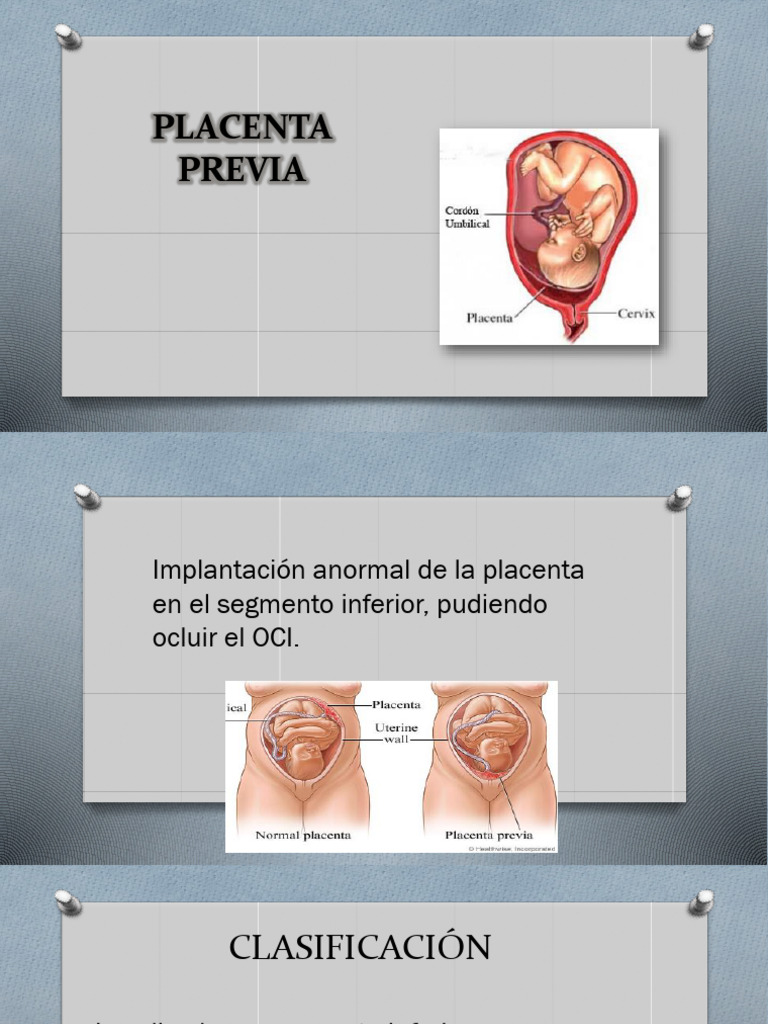 Semana 5 DPP | PDF | Parto | El embarazo
