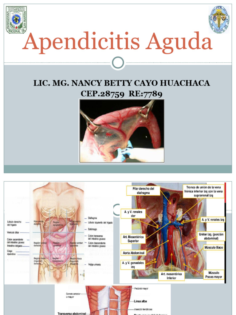 Guía de Apendicitis Aguda | PDF | Enfermedades y trastornos | Anatomía
