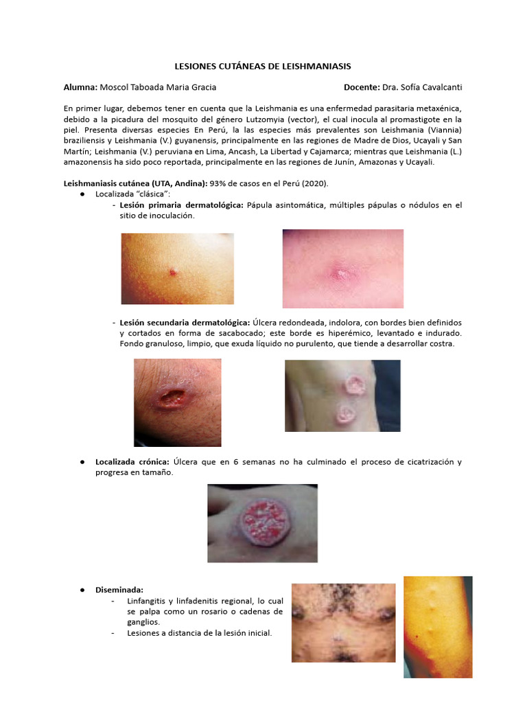 Lesiones Cutáneas por Leishmaniasis | PDF | Especialidades Medicas ...