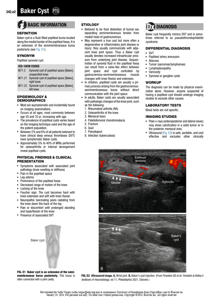 Baker Cyst: Basic Information Diagnosis | PDF | Knee | Medicine