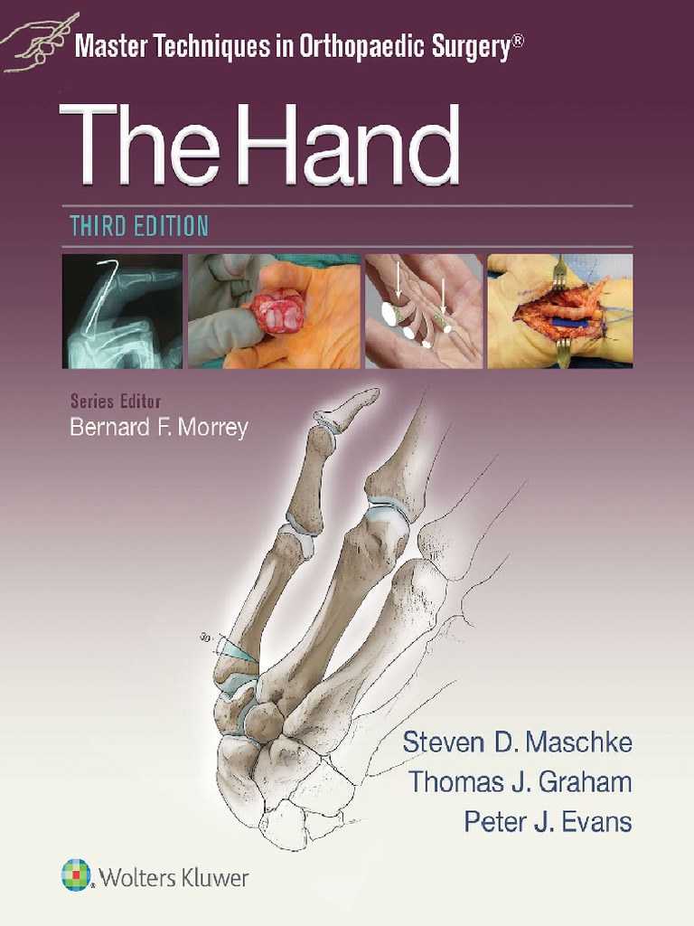 Techniques in Orthopaedic Surgery The Hand 3rd Edition 3nbsped | PDF | Finger | Nail (Anatomy)