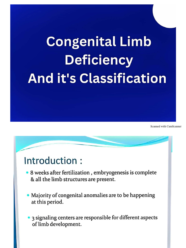Congenital Limb Deficiency & It's Classification | PDF