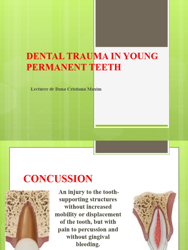 Dental Trauma: Concussion in Young Teeth | PDF | Periodontology | Tooth ...