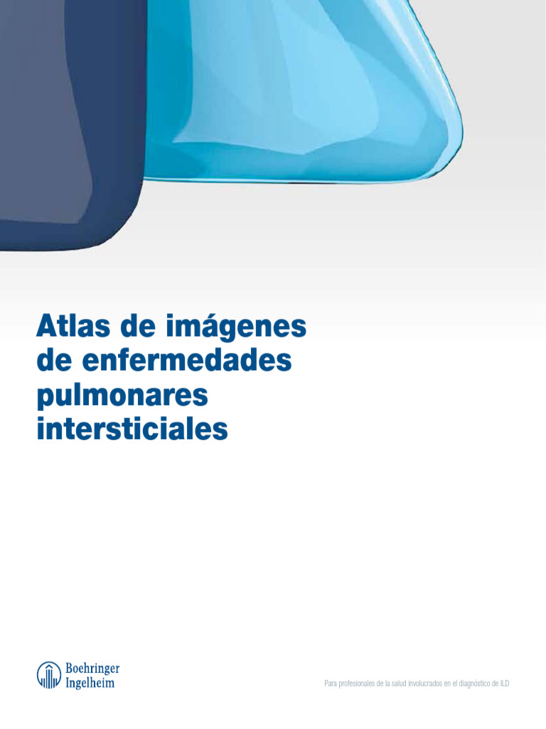 Atlas Intersticio OFEV | PDF | Neumonía | Pulmón