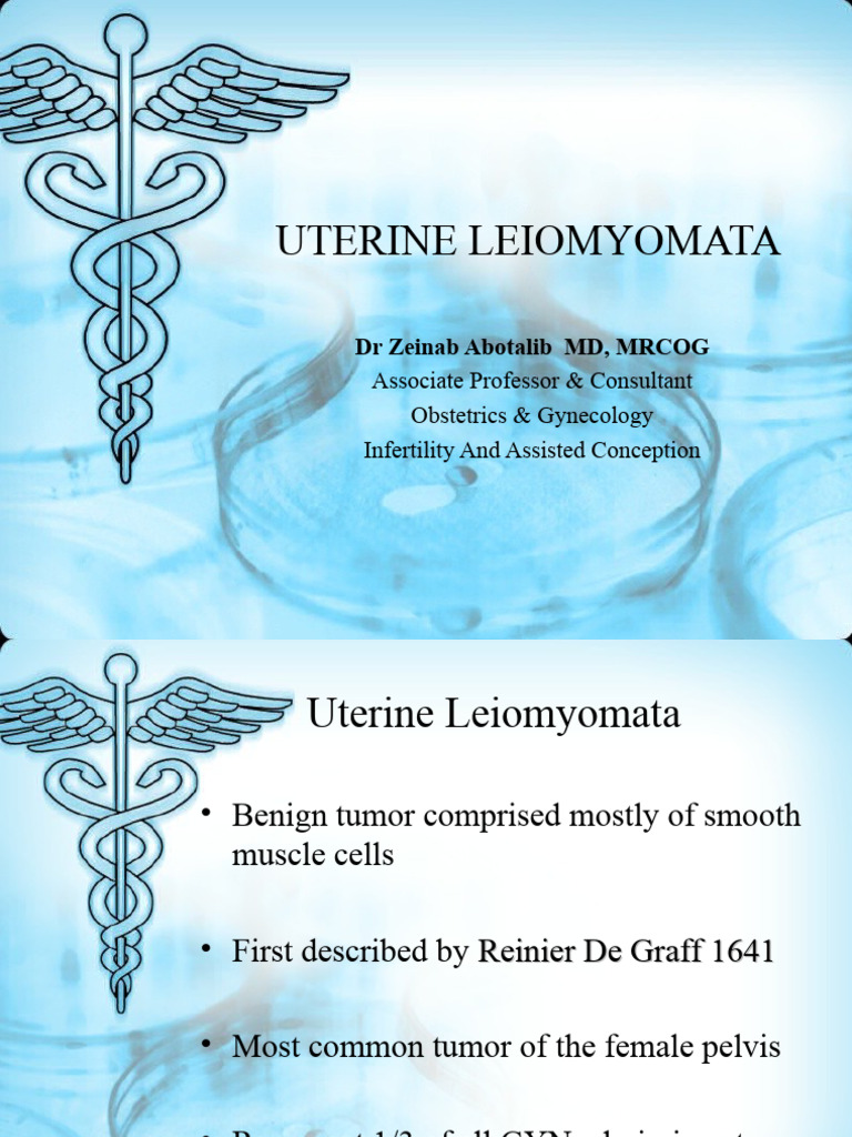 20. Fibroids | PDF | Human Reproduction | Mammal Female Reproductive System