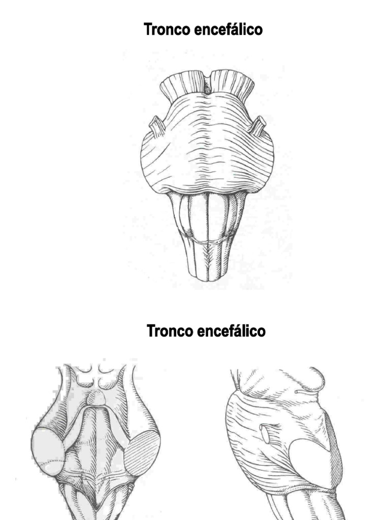 Imagenes de Tronco Encefálico | PDF