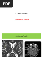 CT Brain Interpretation Guide | PDF | Stroke | Cerebrospinal Fluid