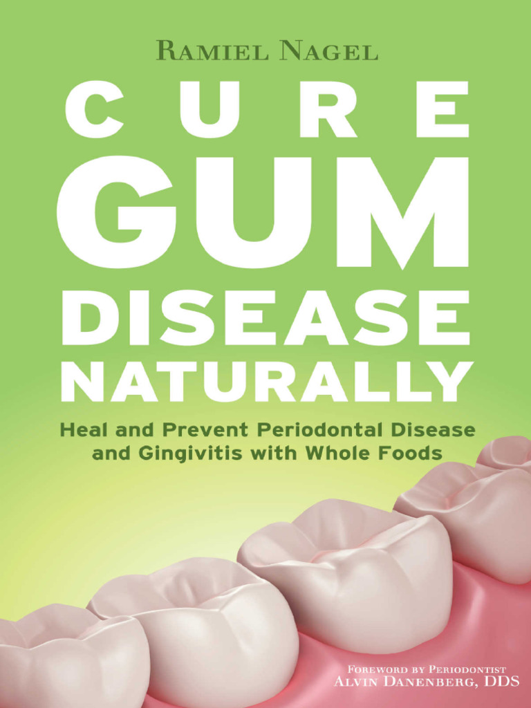 Cure Gum Disease Naturally Heal Gingivitis and Periodontal Disease With ...