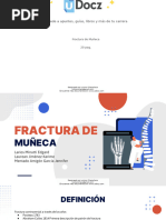 Clasificacion de Fernandez para Fracturas Distales de Radio: Issac ...