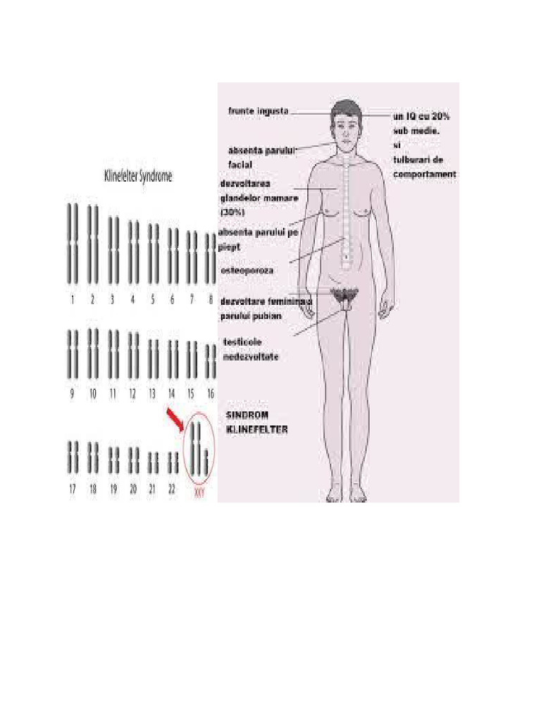 Sindromul Kienefielder (Imagini) | PDF