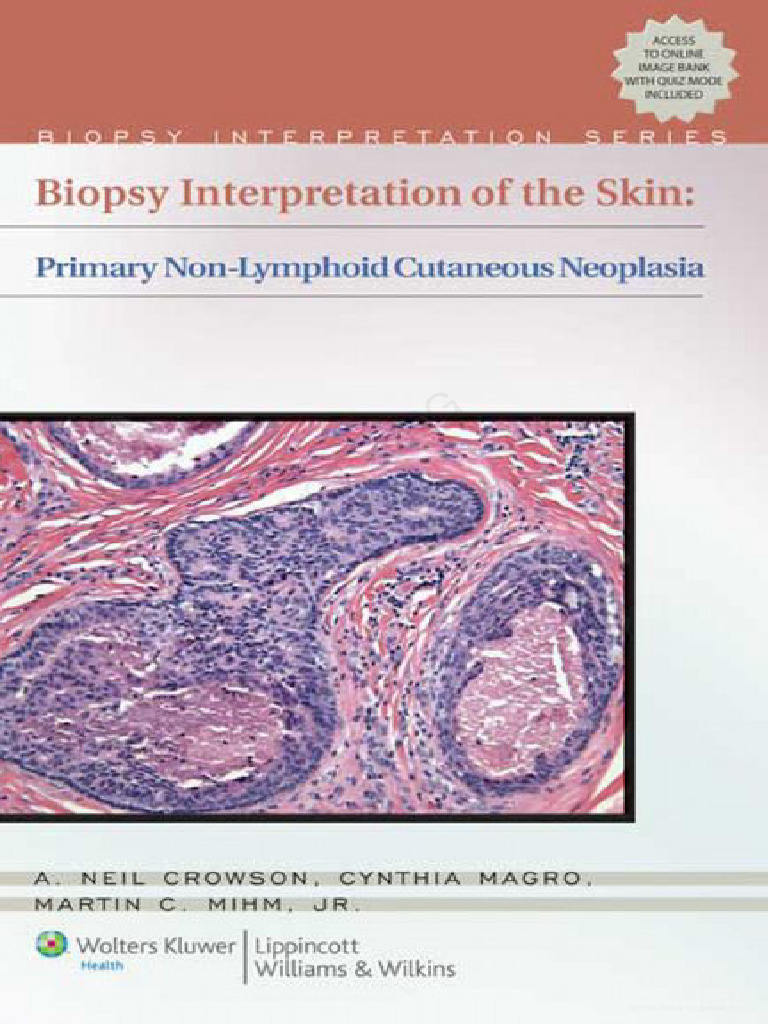 Skin Biopsy Interpretation Guide | PDF | Epidermis | Integumentary System