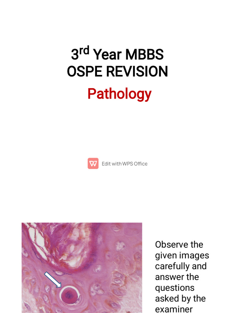 3rd Year OSPE Revision | PDF