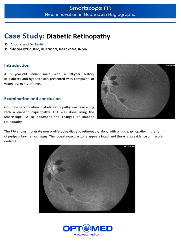 Case Study Diabetic Retinopathy | PDF