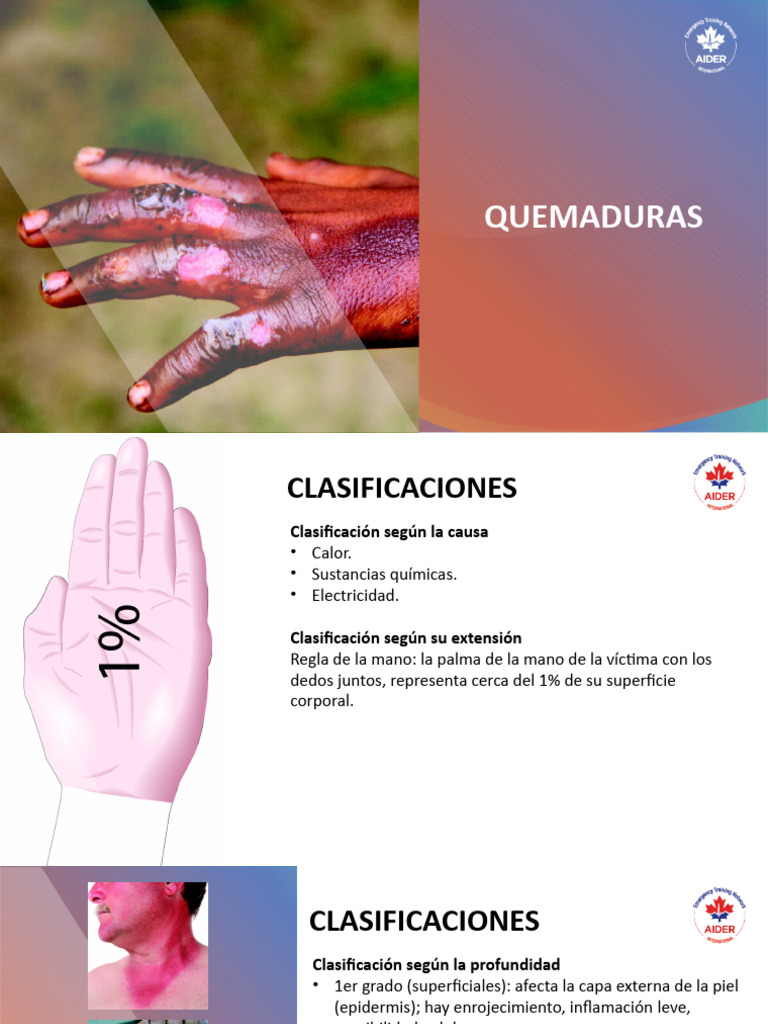 Clasificación y manejo de quemaduras | PDF | Quemar | Piel