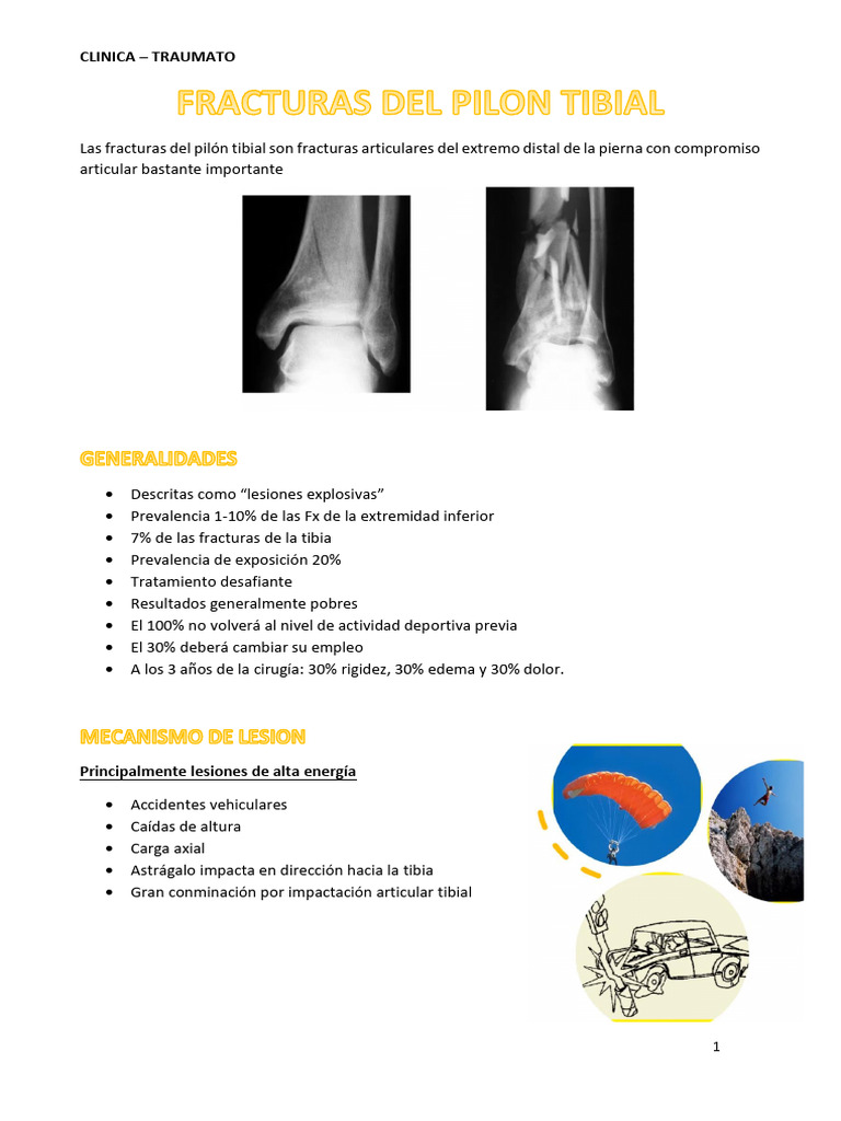 Fracturas de Pilón Tibial: Clasificación y Tratamiento | PDF | Tobillo | Cirugía