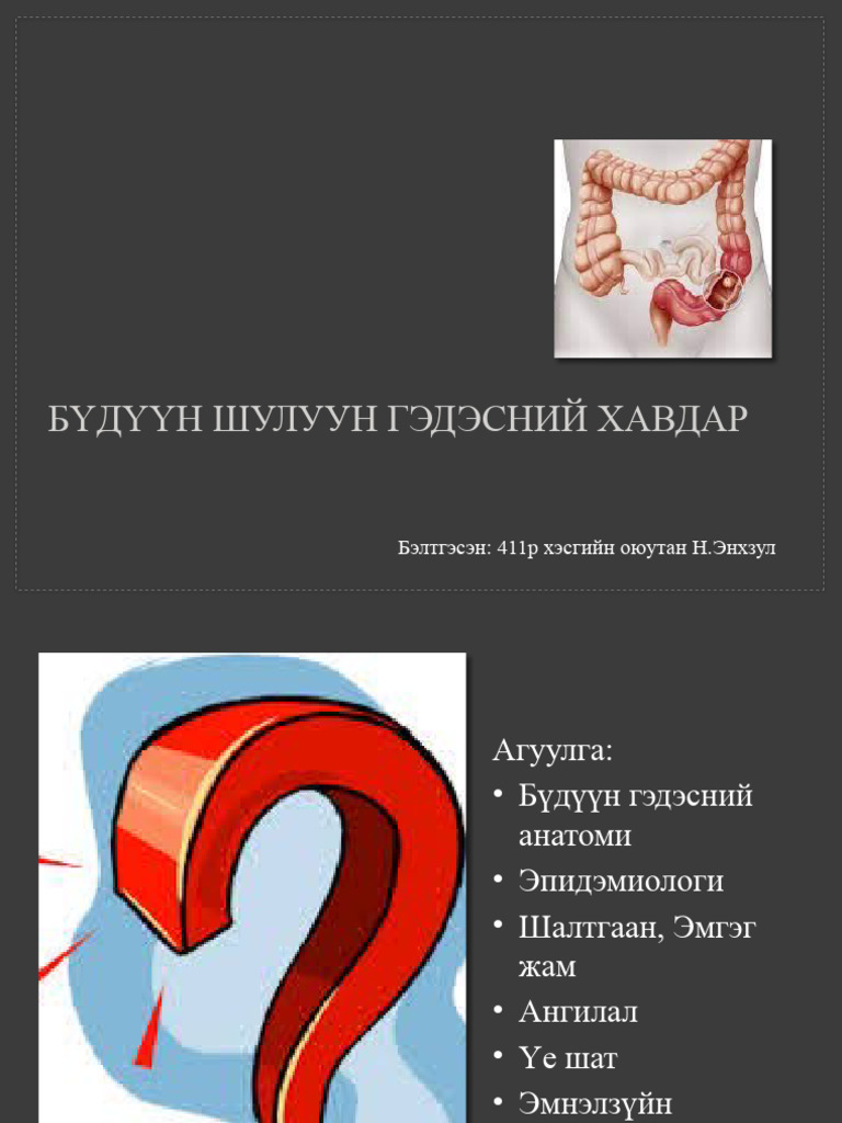 Бүдүүн шулуун гэдэсний хавдар Pdf