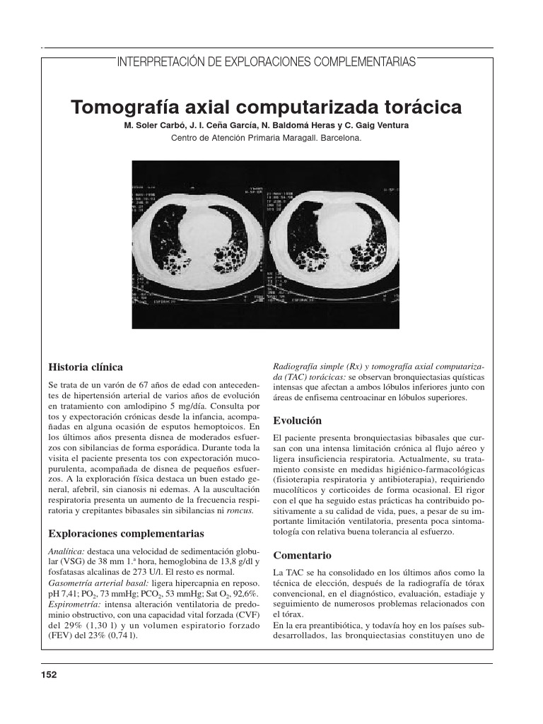 Tomografía Axial Computarizada Torácica: Interpretación de Exploraciones Complementarias | PDF