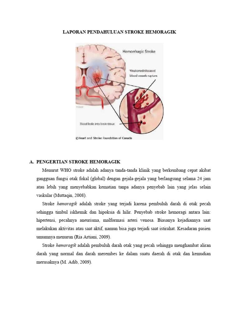 Laporan Pendahuluan Stroke Hemoragik | PDF