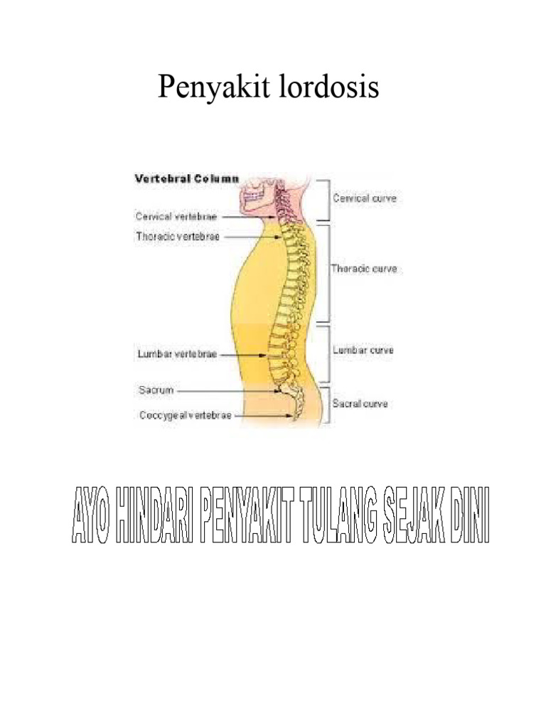 Penyakit Lordosis | PDF