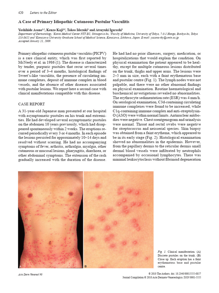 Pustular Vasculitis | Download Free PDF | Diseases And Disorders ...