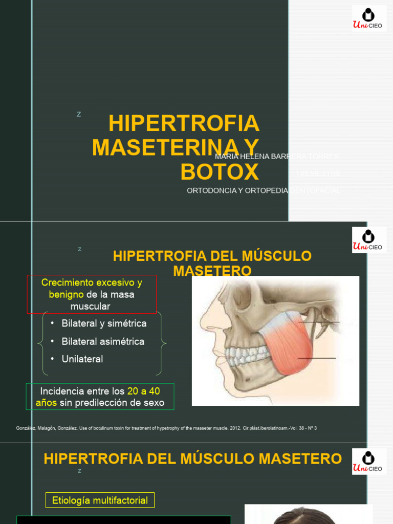 Hipertrofia Del Músculo Masetero | PDF | Medicina CLINICA ...