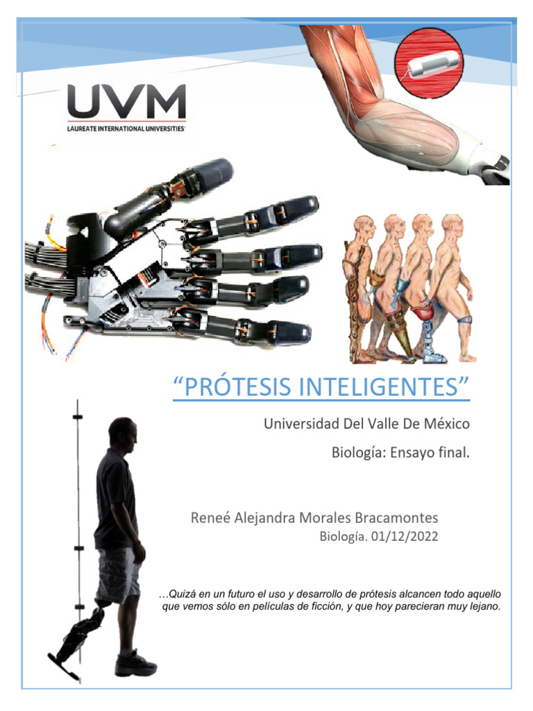 Prótesis Inteligentes: Innovación y Retos | PDF | Mente | Biomecánica