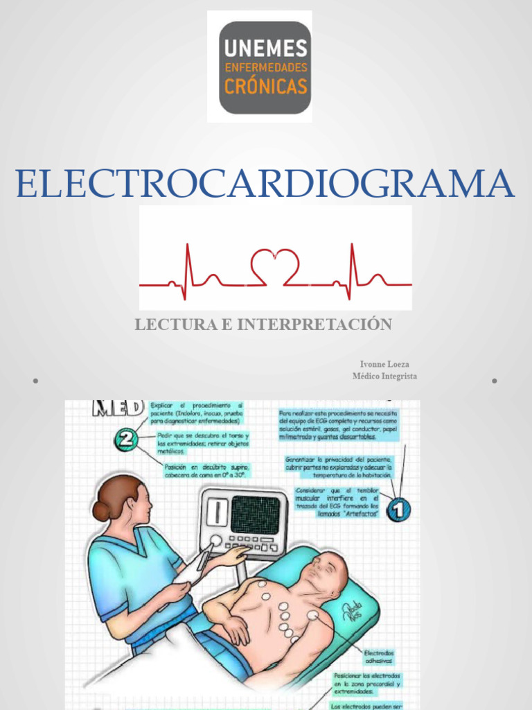 1 Ekg | PDF | Electrocardiografia | Electrofisiologia