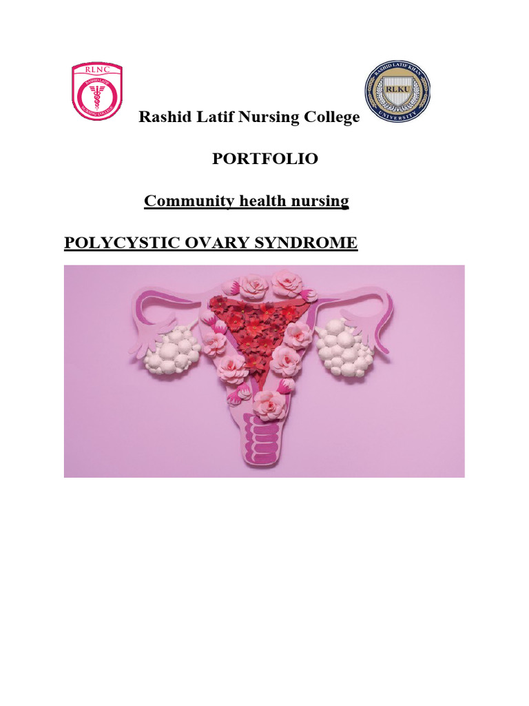 Pcos Case Study | PDF | Polycystic Ovary Syndrome | Health Care