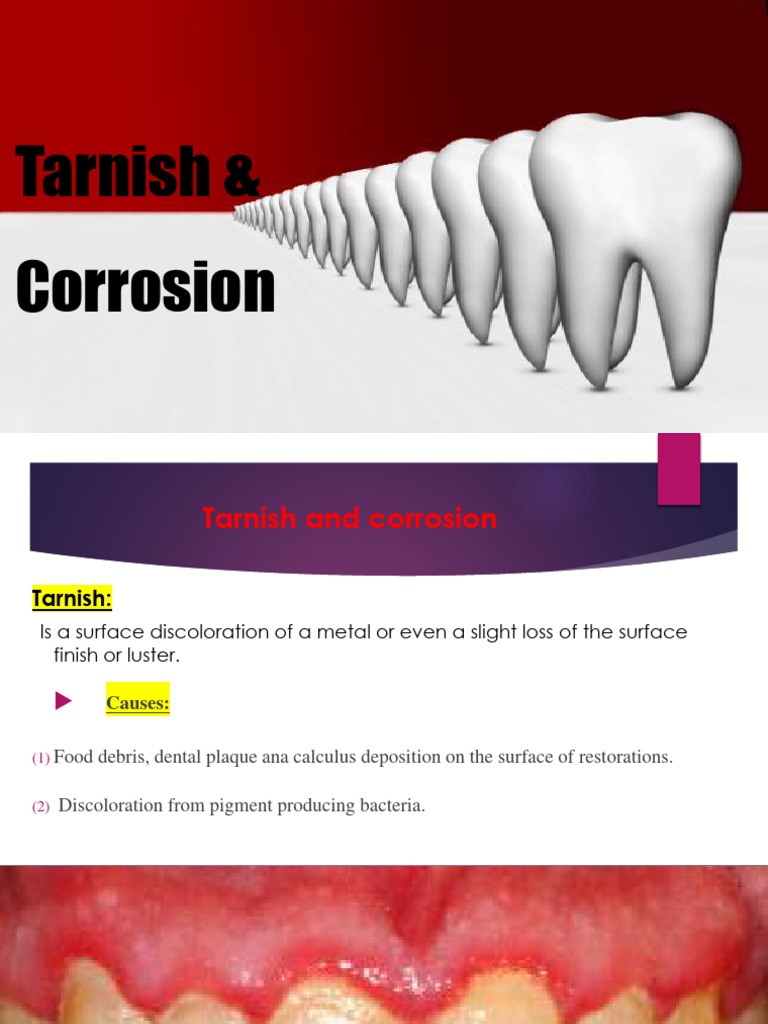 Tarnish &corrosion | PDF | Corrosion | Anode