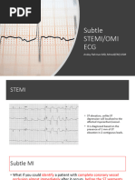 Ecg Interpretation J Point Stemi Criteria Equivalents and Others | PDF ...