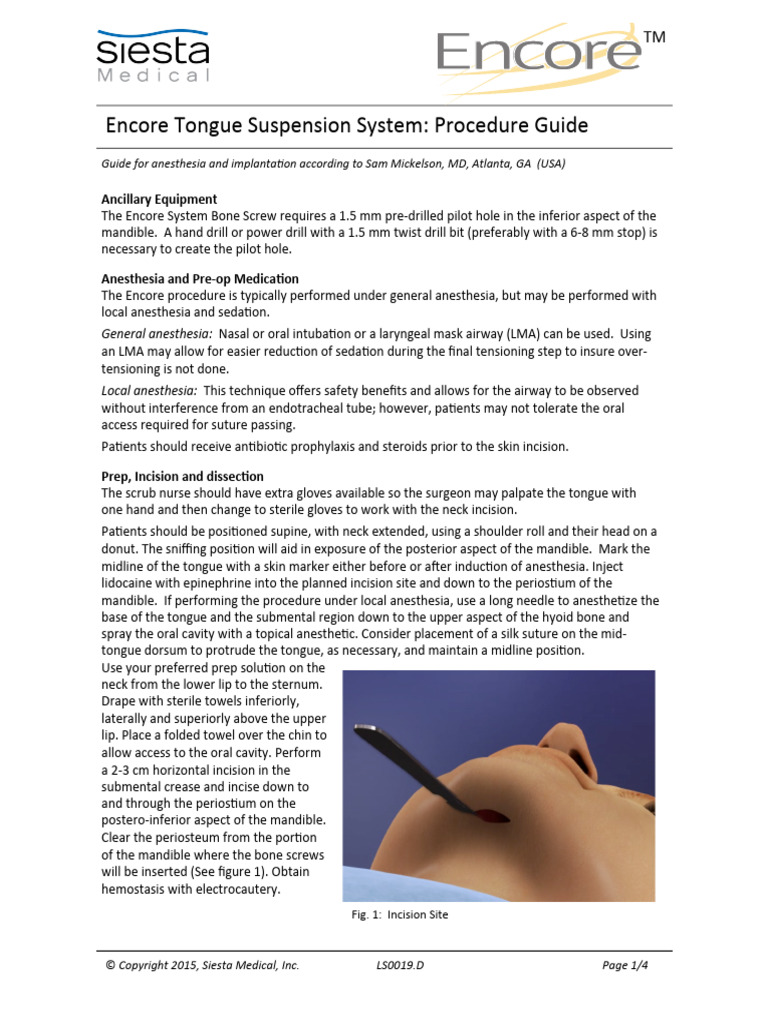 AirLift™ Tongue Suspension Technique Guide | PDF | Surgical Suture ...